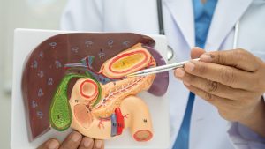 What to Expect During Gallbladder Removal Surgery: A Guide