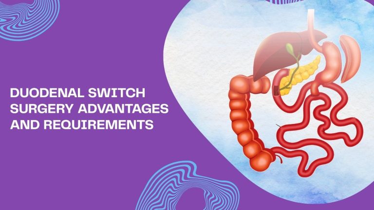 Advantages Of Duodenal Switch Surgery Explained